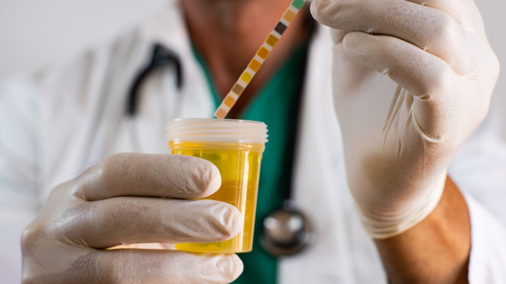 La orina verde y sus causas: todo lo que necesitas saber